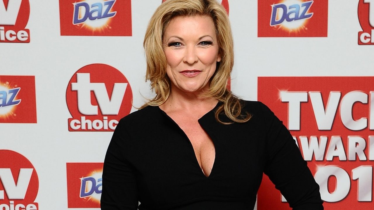 Corrie’s Claire King (52) says facelift saved her career | Irish ...