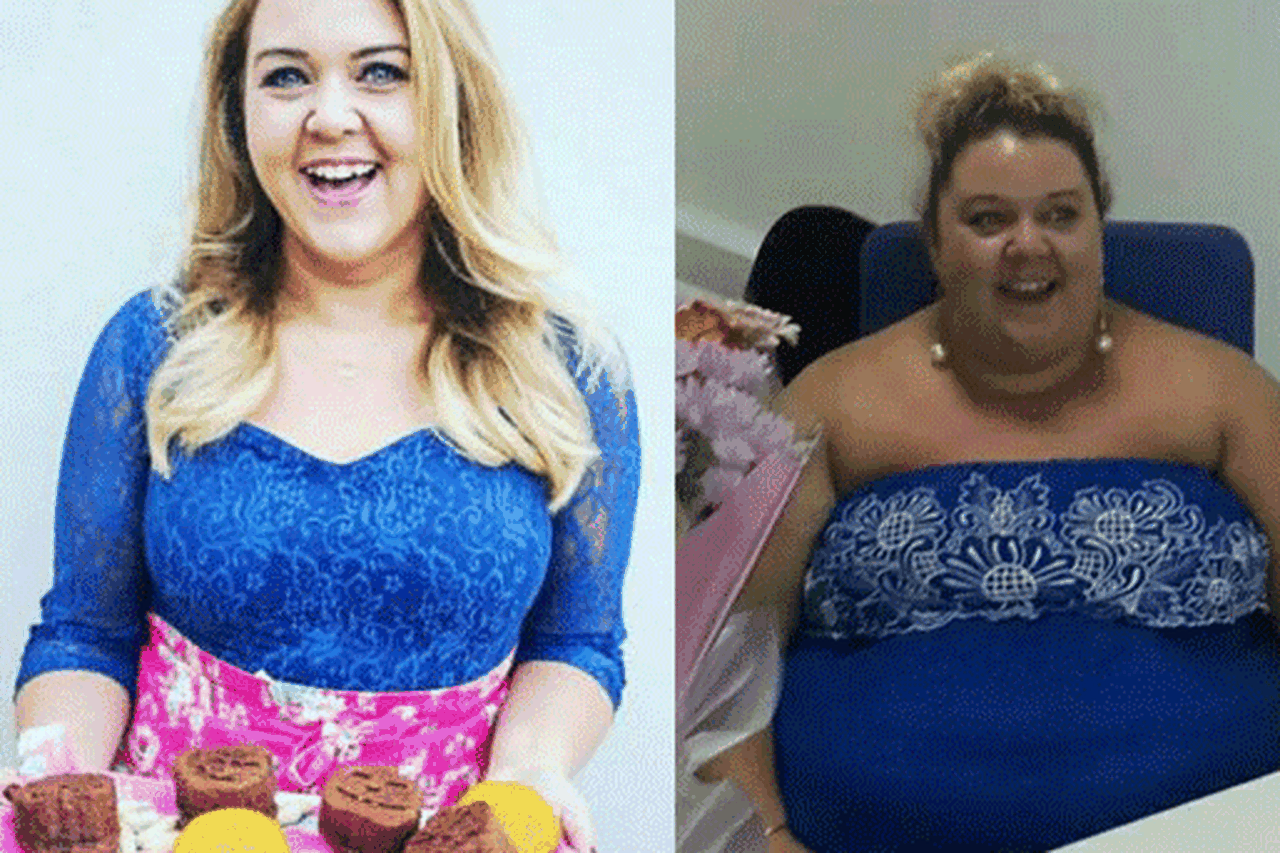 Before and After: What do these ten Irish people look like after ...