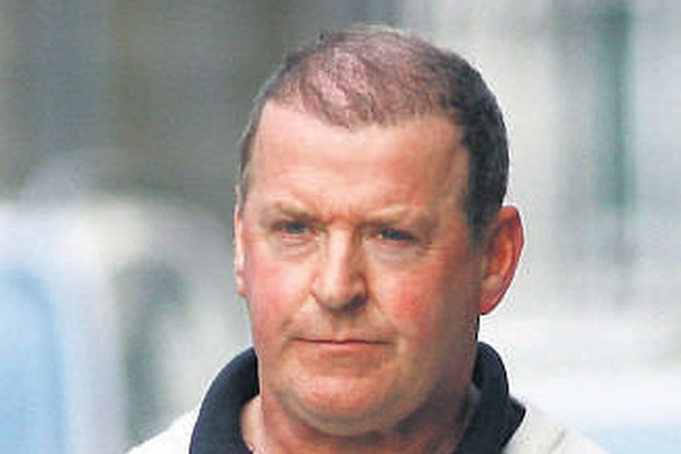 Car dealer forced to pay doctor €17,000 for hair transplant | Irish ...