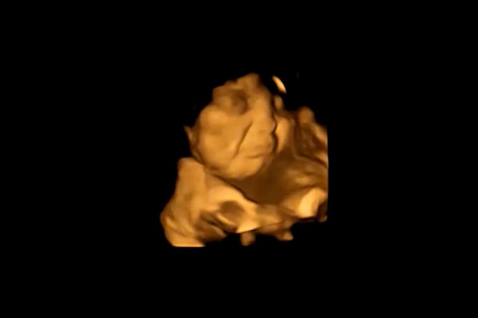 Amazing pictures show babies in womb smiling and pulling sad faces in ...