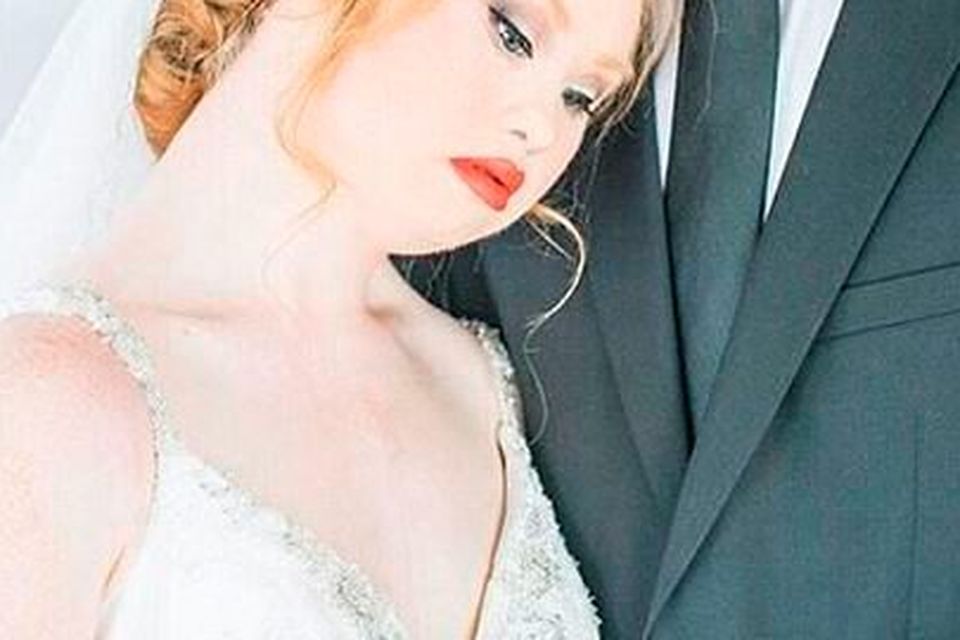 Model with Down Syndrome challenges society's perceptions by starring ...