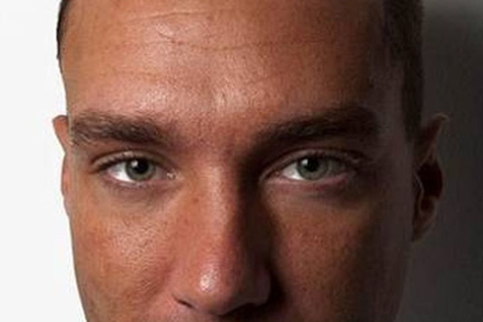 Mane attraction: Calum Best has a hair transplant ahead of Celebrity ...