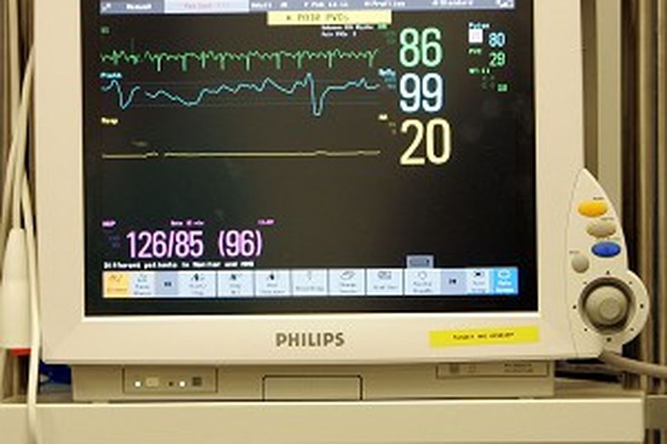 Heart monitor 'breakthrough' hailed | Irish Independent