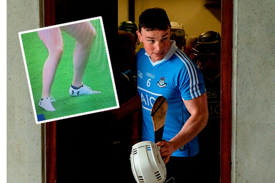 Dublin's Liam Rushe sets new GAA trend - is he wearing ankle socks or ...
