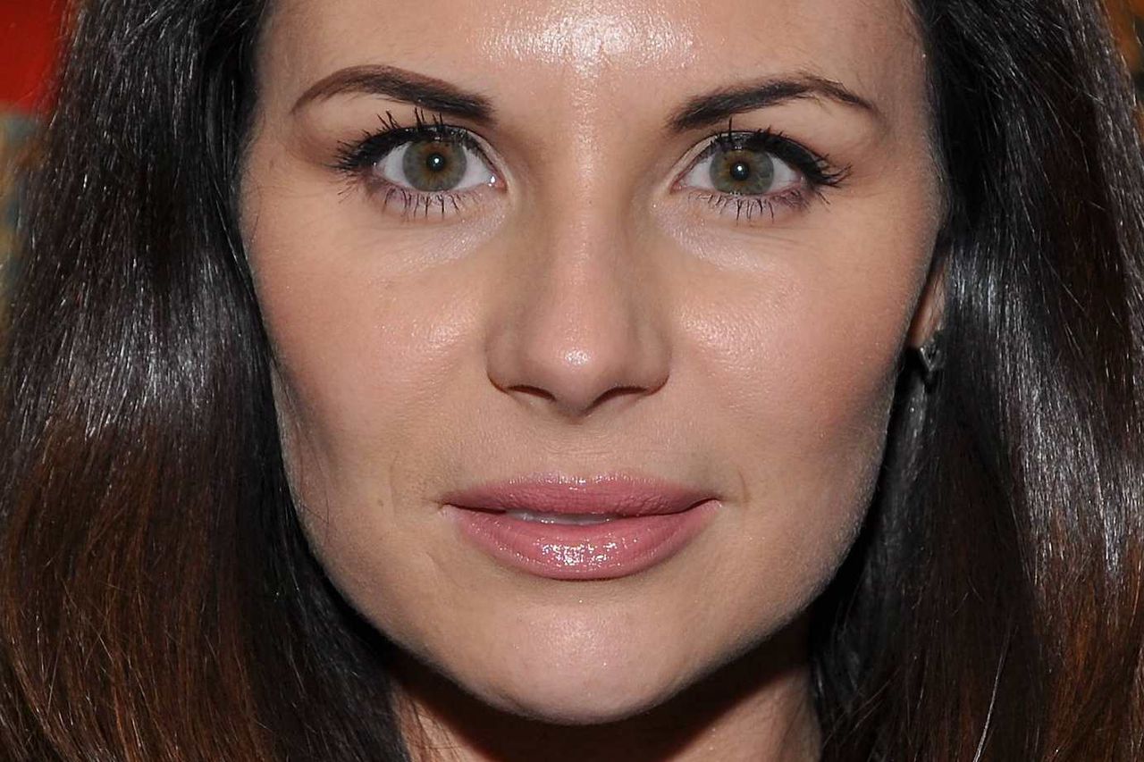 Xpose presenter Lisa Cannon opens up about developing adult acne ...