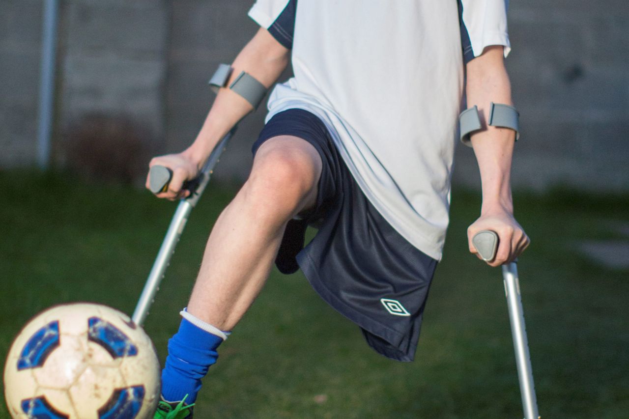 Dubliner Neil goes from losing a leg at 11 to Irish amputee football ...