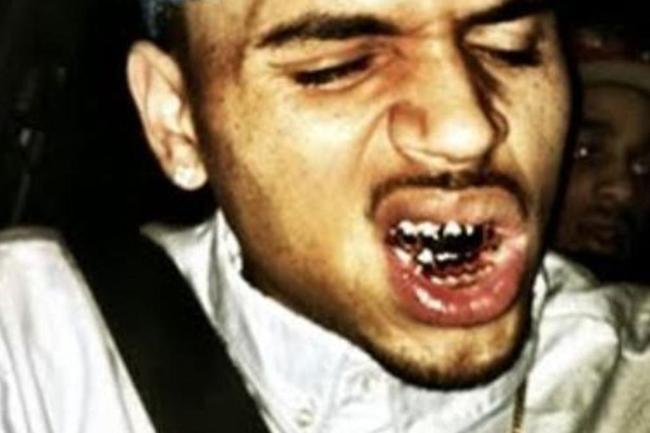 Celebrities show off their grills | Irish Independent
