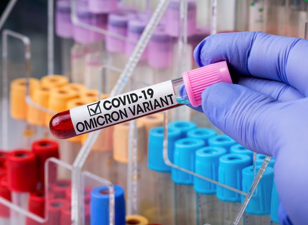 Hospital and GP patients to be hit by test delays as laboratory ...